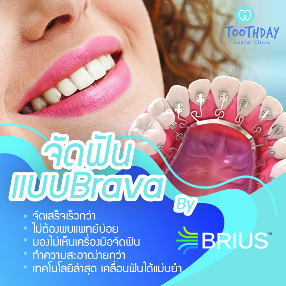จัดฟัน Brava | Toothday Dental Clinic คลินิกทันตกรรมทูธเดย์